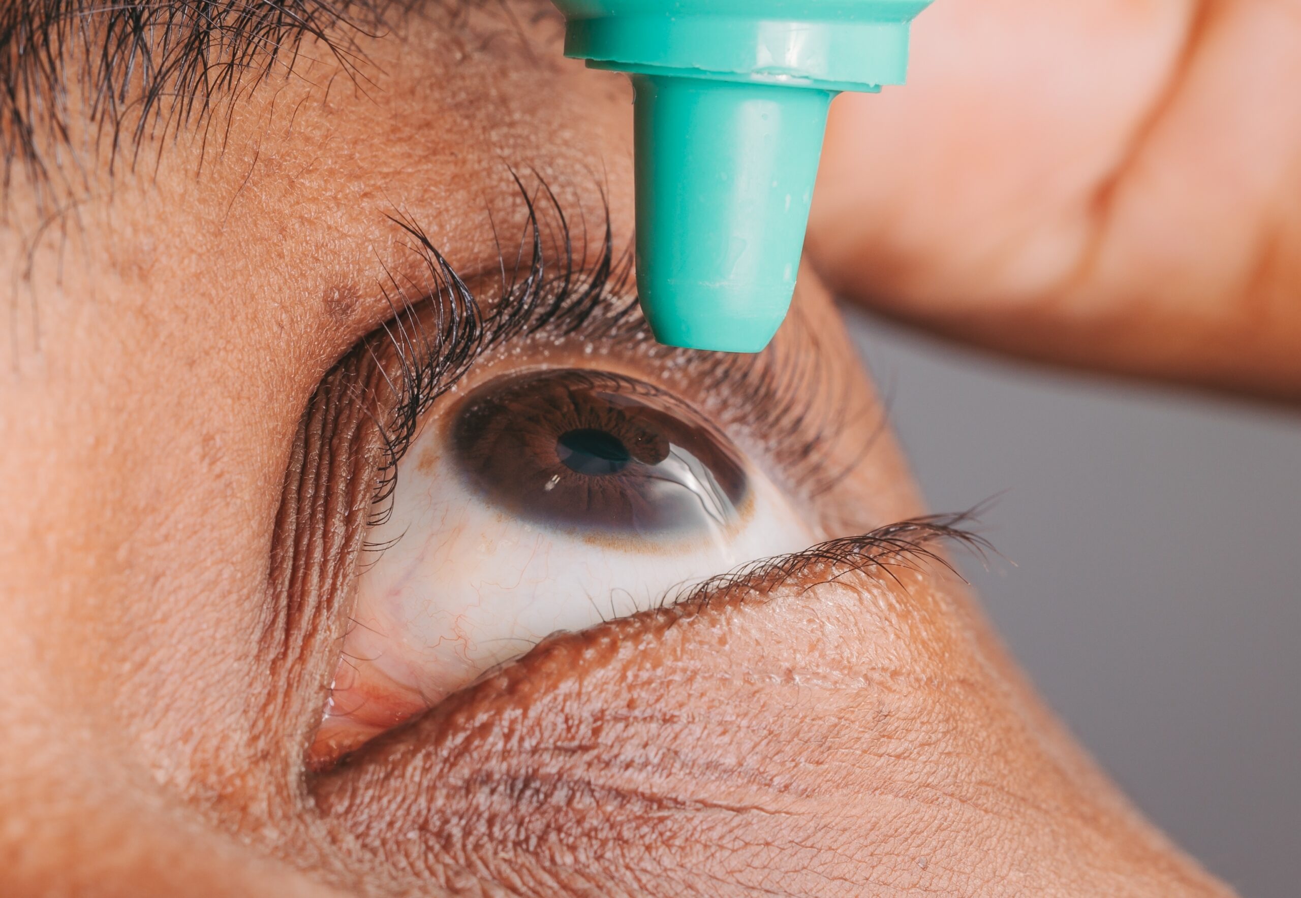 Dry Eye Treatment in Marion | Dry Eye Prevention Illinois | Missouri
